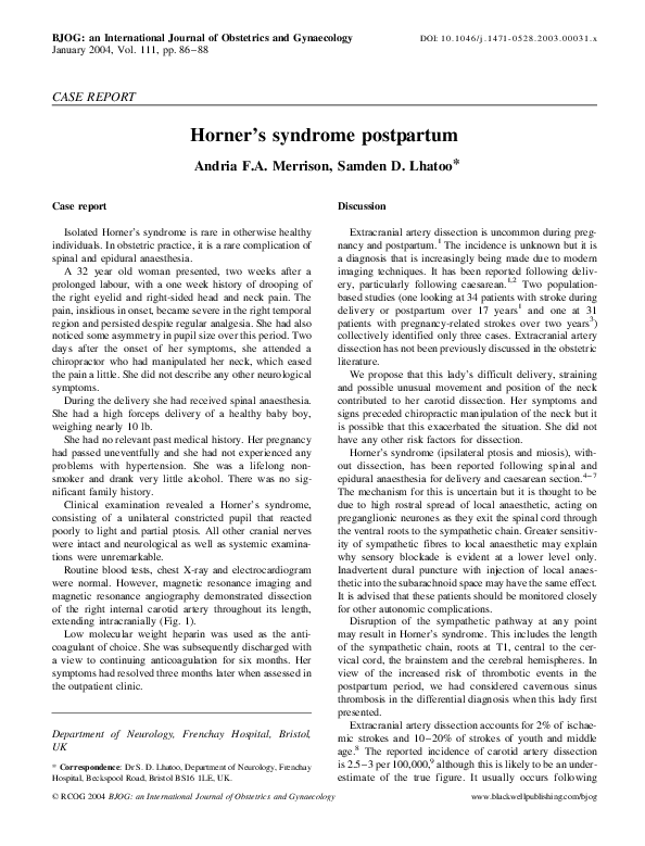 (PDF) Horner's syndrome postpartum