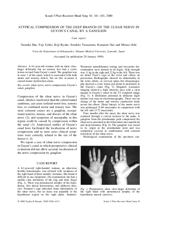 (PDF) ATYPICAL COMPRESSION OF THE DEEP BRANCH OF THE ULNAR NERVE IN ...