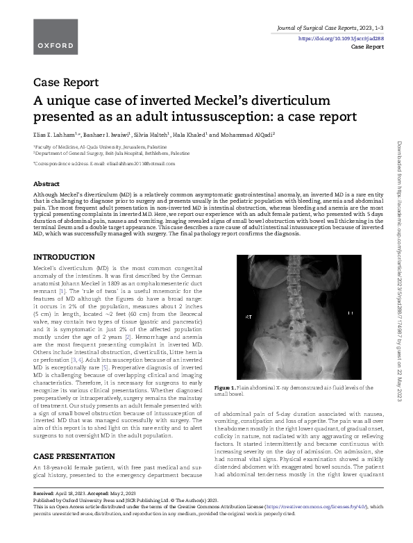 (PDF) A unique case of inverted Meckel’s diverticulum presented as an ...