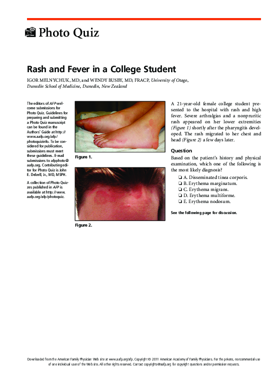(PDF) Rash and fever in a college student