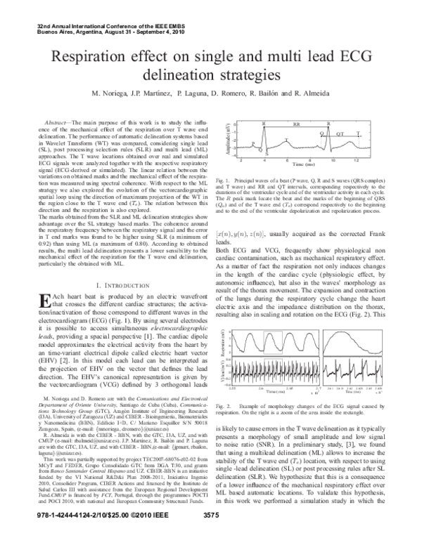 (PDF) Respiration effect on single and multi lead ECG delineation ...