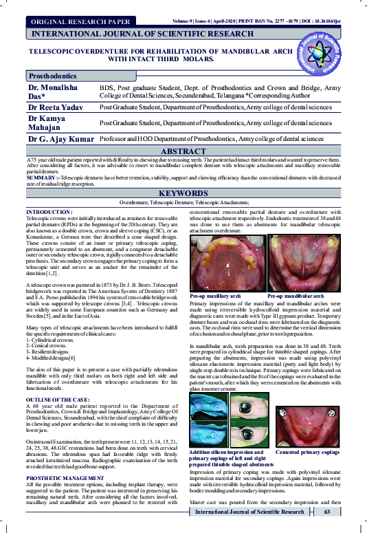 (PDF) Telescopic Overdenture For Rehabilitation Of Mandibular Arch With ...