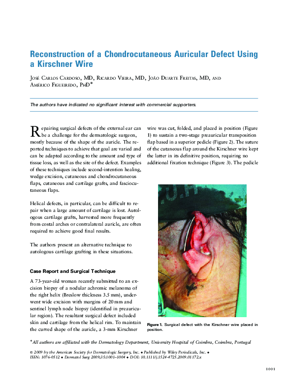 (PDF) Reconstruction of a Chondrocutaneous Auricular Defect Using a ...