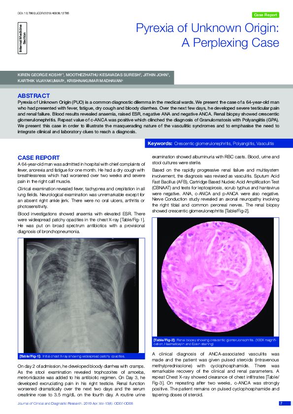 (PDF) Pyrexia of Unknown Origin: A Perplexing Case