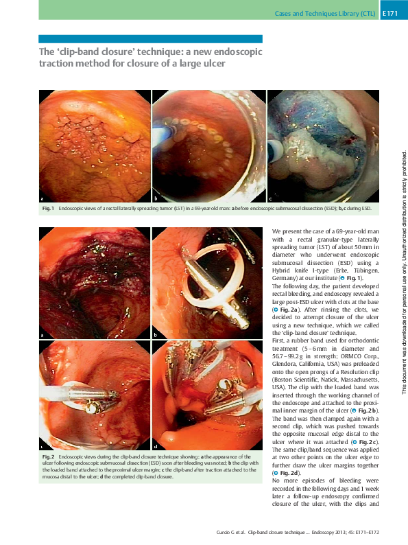 (PDF) The ‘clip-band closure' technique: a new endoscopic traction ...