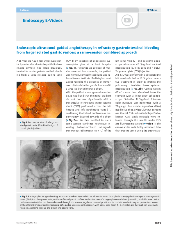 (PDF) Endoscopic ultrasound-guided angiotherapy in refractory ...