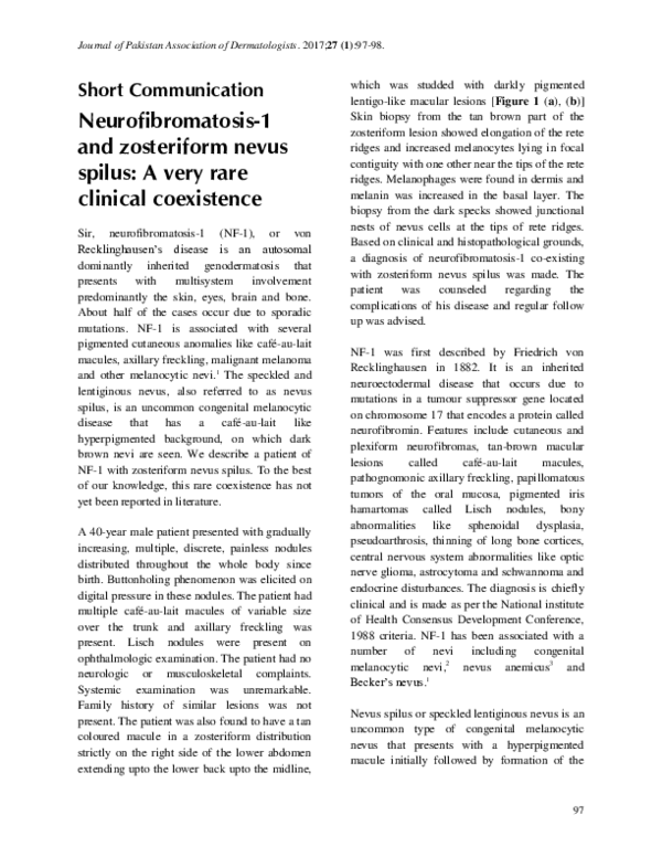 (PDF) Neurofibromatosis-1 and zosteriform nevus spilus: A very rare ...