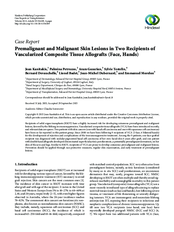 (PDF) Premalignant and Malignant Skin Lesions in Two Recipients of ...