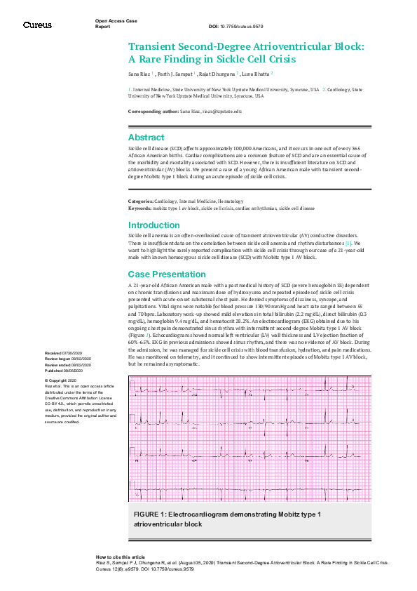 (PDF) Transient Second-Degree Atrioventricular Block: A Rare Finding in ...