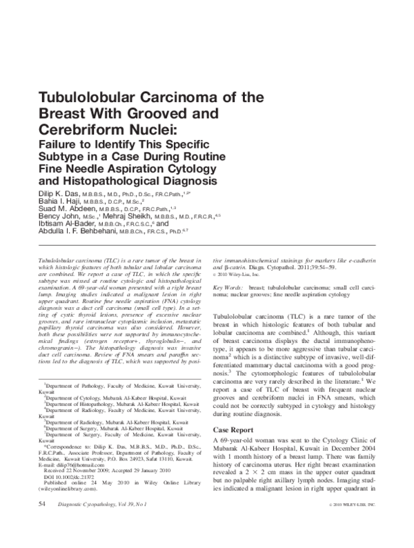 (PDF) Tubulolobular carcinoma of the breast with grooved and ...