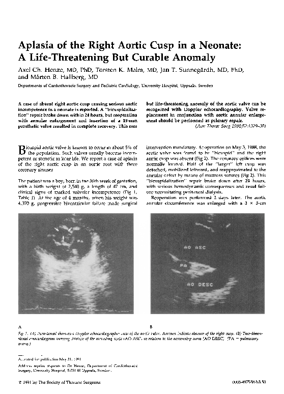 (PDF) Aplasia of the right aortic cusp in a neonate: A life-threatening ...