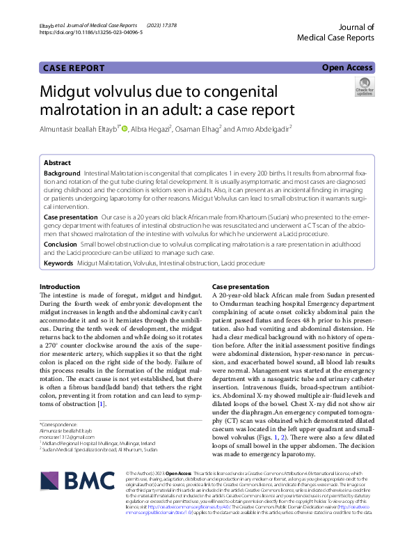 (PDF) Midgut volvulus due to congenital malrotation in an adult: a case ...