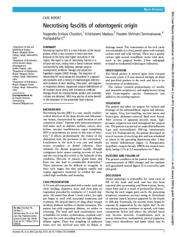 (PDF) Necrotising fasciitis of odontogenic origin