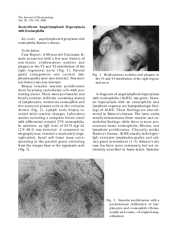(PDF) Zosteriform Angiolymphoid Hyperplasia with Eosinophilia