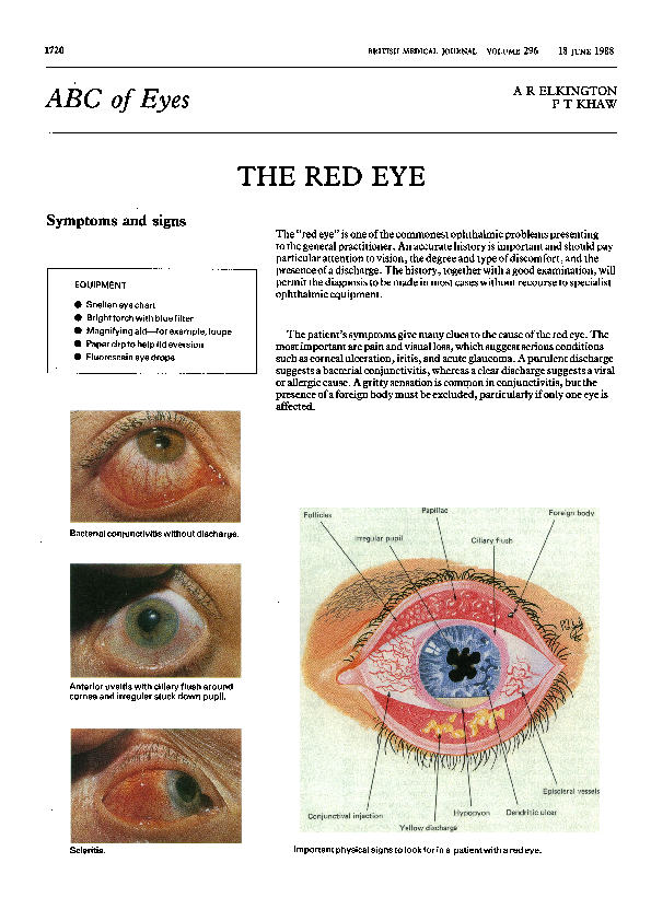 (PDF) ABC of Eyes: The red eye