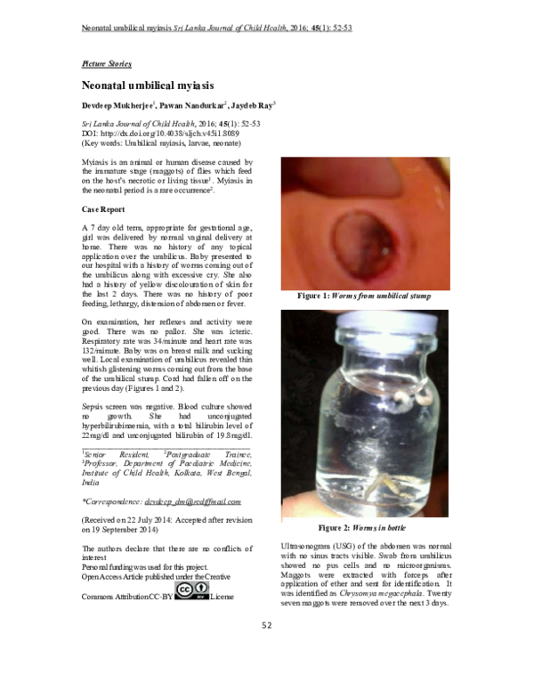 (PDF) Neonatal umbilical myiasis