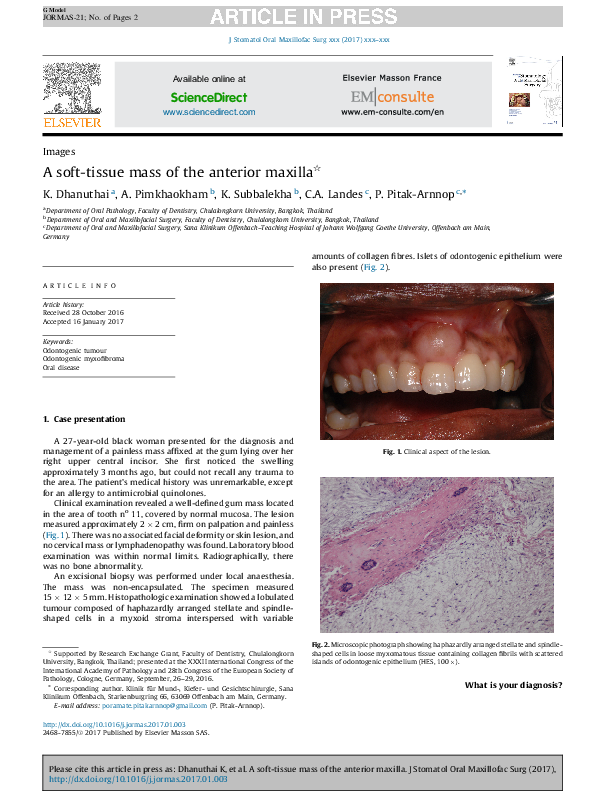(PDF) A soft-tissue mass of the anterior maxilla