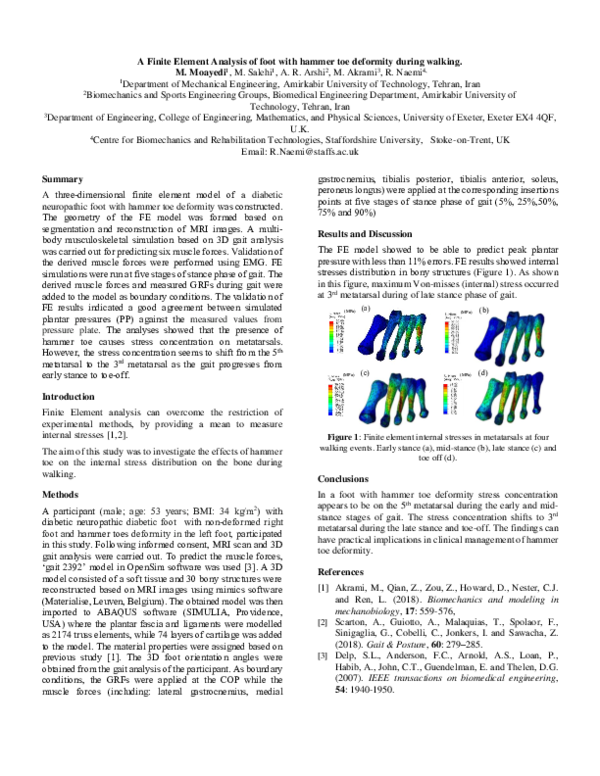 (PDF) A Finite Element Analysis of foot with hammer toe deformity ...