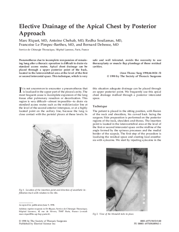 (PDF) Elective drainage of the apical chest by posterior approach