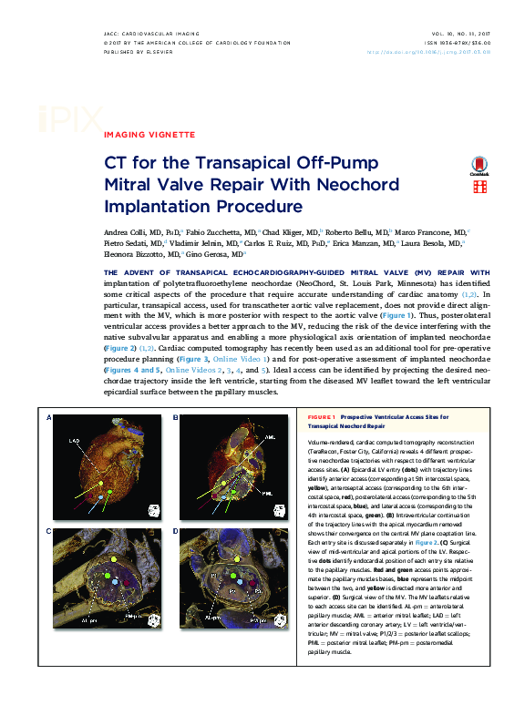 (PDF) CT for the Transapical Off-Pump Mitral Valve Repair With Neochord ...