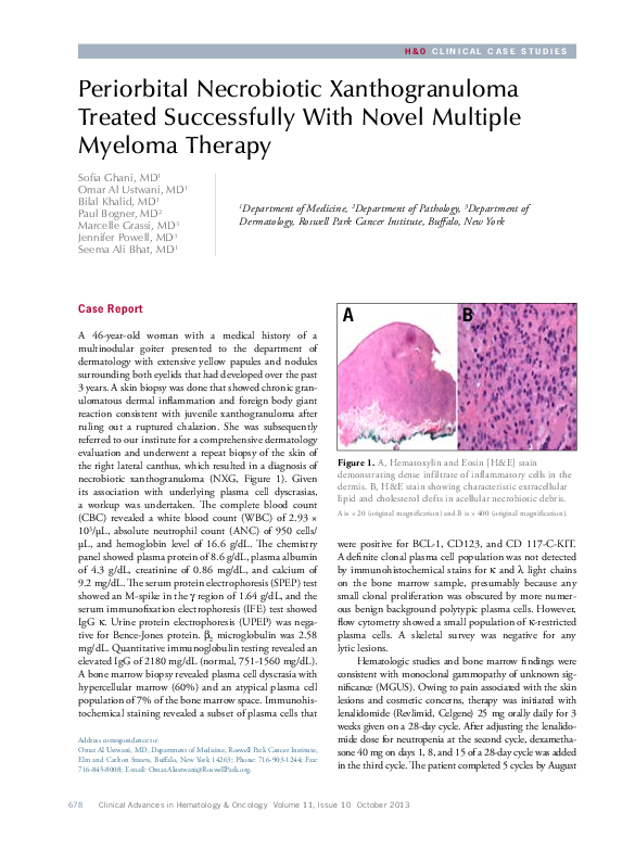 (PDF) Periorbital necrobiotic xanthogranuloma treated successfully with ...