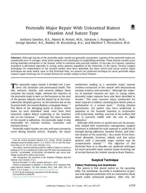 (PDF) Pectoralis Major Repair With Unicortical Button Fixation And ...
