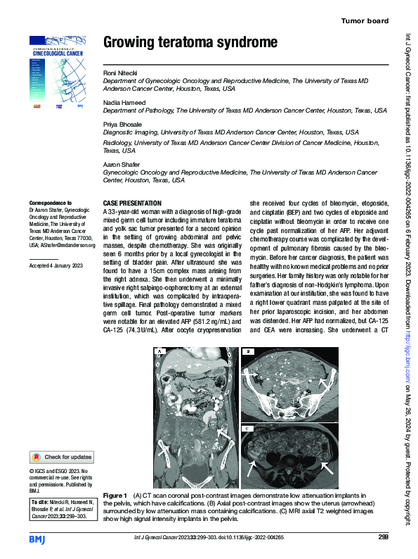 (PDF) Growing teratoma syndrome