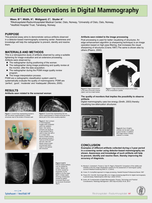 (PDF) Artifact observations in digital mammography