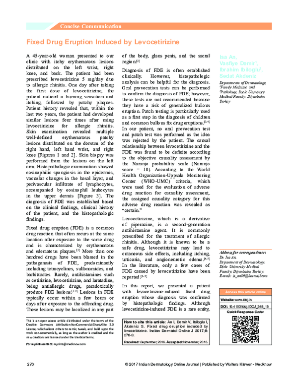 (PDF) Fixed drug eruption induced by levocetirizine