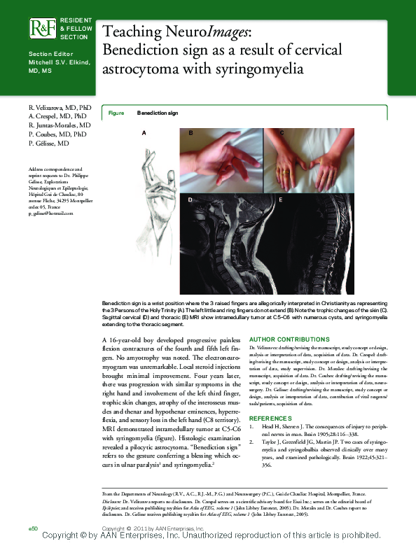 (PDF) Teaching NeuroImages: Benediction sign as a result of cervical ...