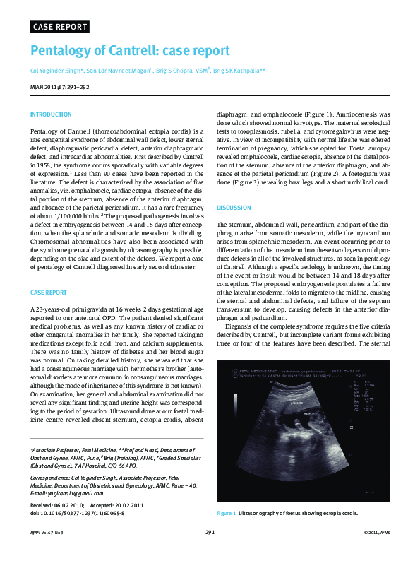 (PDF) Pentalogy of Cantrell: case report