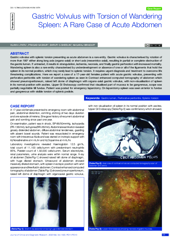 (PDF) Gastric Volvulus with Torsion of Wandering Spleen: A Rare Case of ...