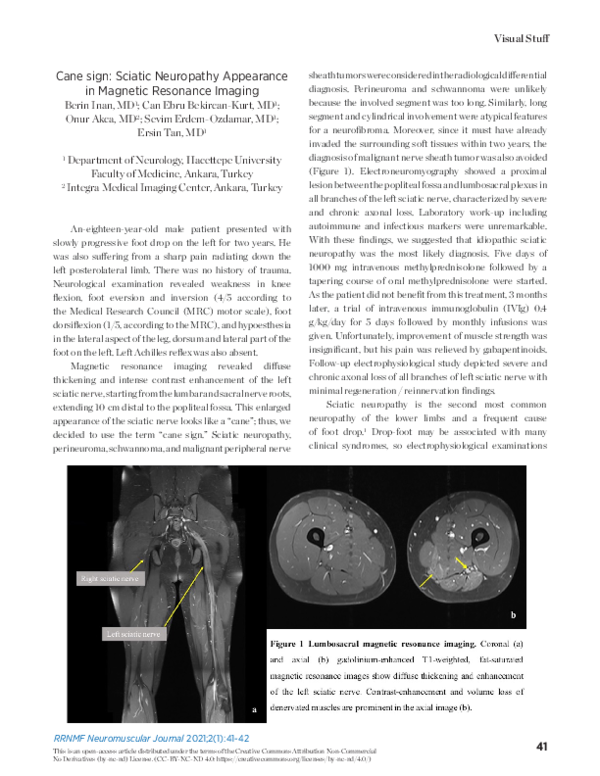 (PDF) Cane sign: sciatic neuropathy appearance in magnetic resonance ...