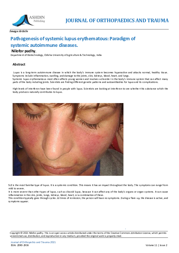 (PDF) Pathogenesis of systemic lupus erythematous: Paradigm ofsystemic ...