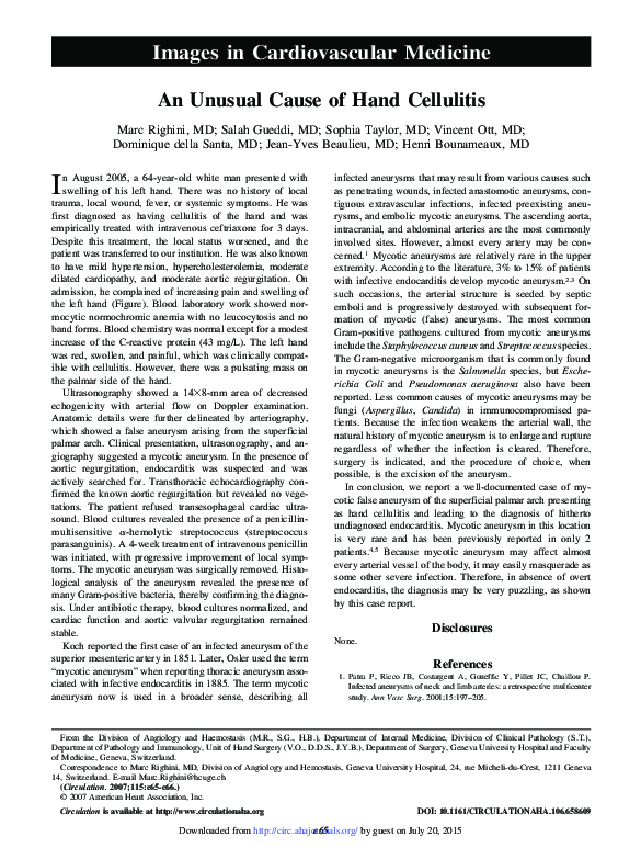 (PDF) An Unusual Cause of Hand Cellulitis