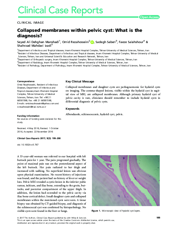 (PDF) Collapsed membranes within pelvic cyst: What is the diagnosis?