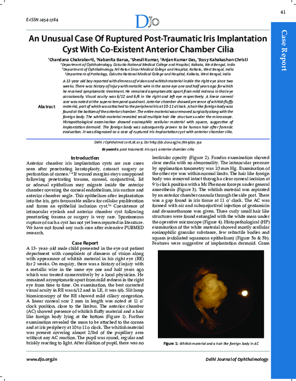 (PDF) An Unusual Case Of Ruptured Post-Traumatic Iris Implantation Cyst ...