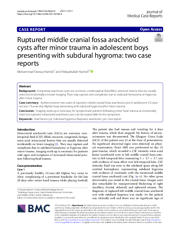 (PDF) Ruptured middle cranial fossa arachnoid cysts after minor trauma ...