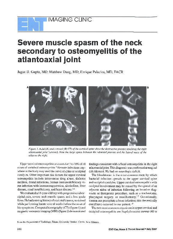 (PDF) Severe Muscle Spasm of the Neck Secondary to Osteomyelitis of the ...