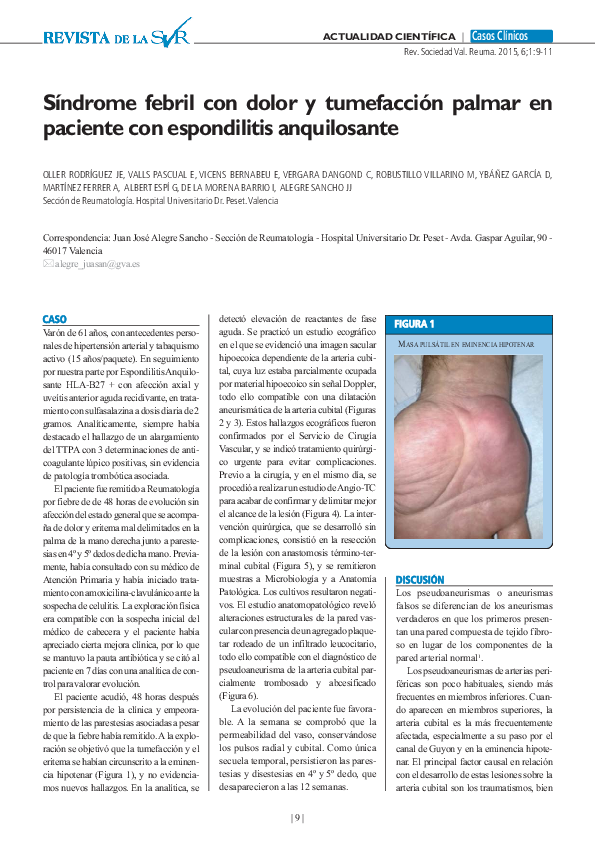 (PDF) Síndrome febril con dolor y tumefacción palmar en paciente con ...