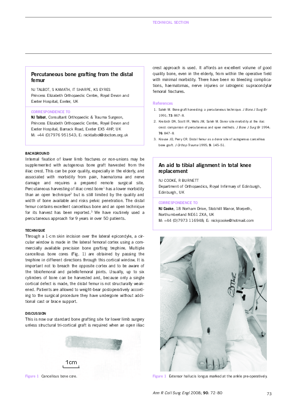 (PDF) An Aid to Tibial Alignment in Total Knee Replacement