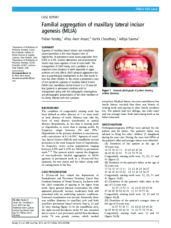 (PDF) Familial aggregation of maxillary lateral incisor agenesis (MLIA)