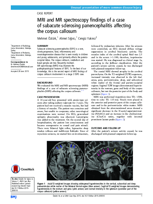 (PDF) MRI and MR spectroscopy findings of a case of subacute sclerosing ...
