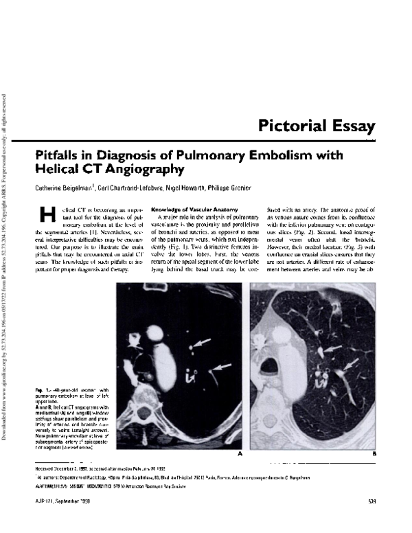 (PDF) Pitfalls in diagnosis of pulmonary embolism with helical CT ...