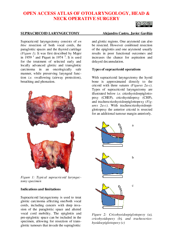 (PDF) Atlas of Otolaryngology , Head & Neck Operative Surgery ...