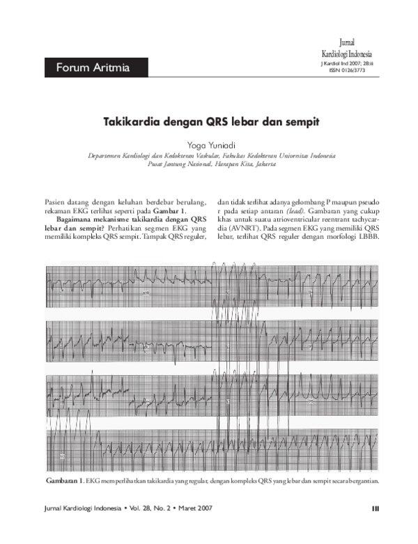 (PDF) Takikardia dengan QRS lebar dan sempit