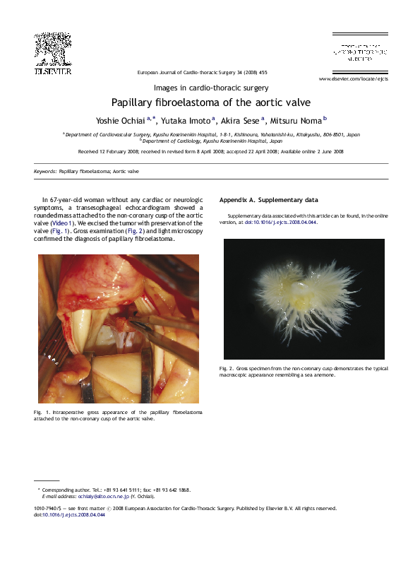 (PDF) Papillary fibroelastoma of the aortic valve