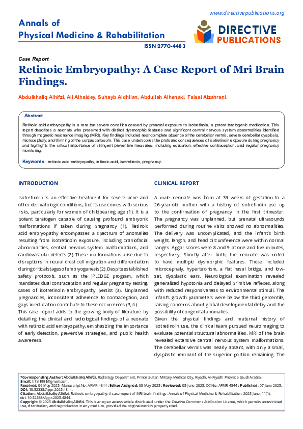 (PDF) Retinoic Embryopathy: A Case Report of Mri Brain Findings