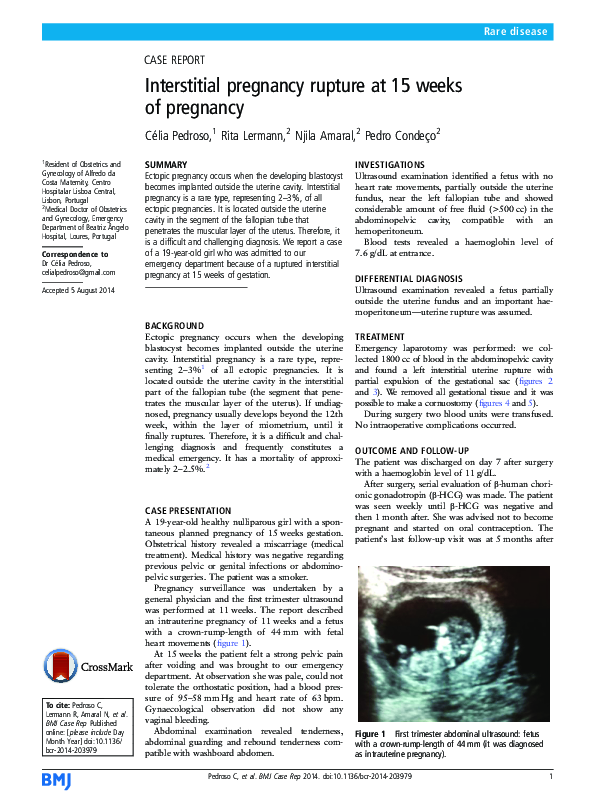 (PDF) Interstitial pregnancy rupture at 15 weeks of pregnancy