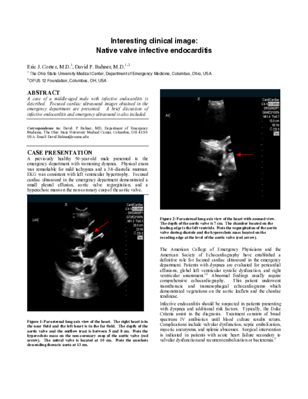 (PDF) Interesting clinical image: Native valve infective endocarditis
